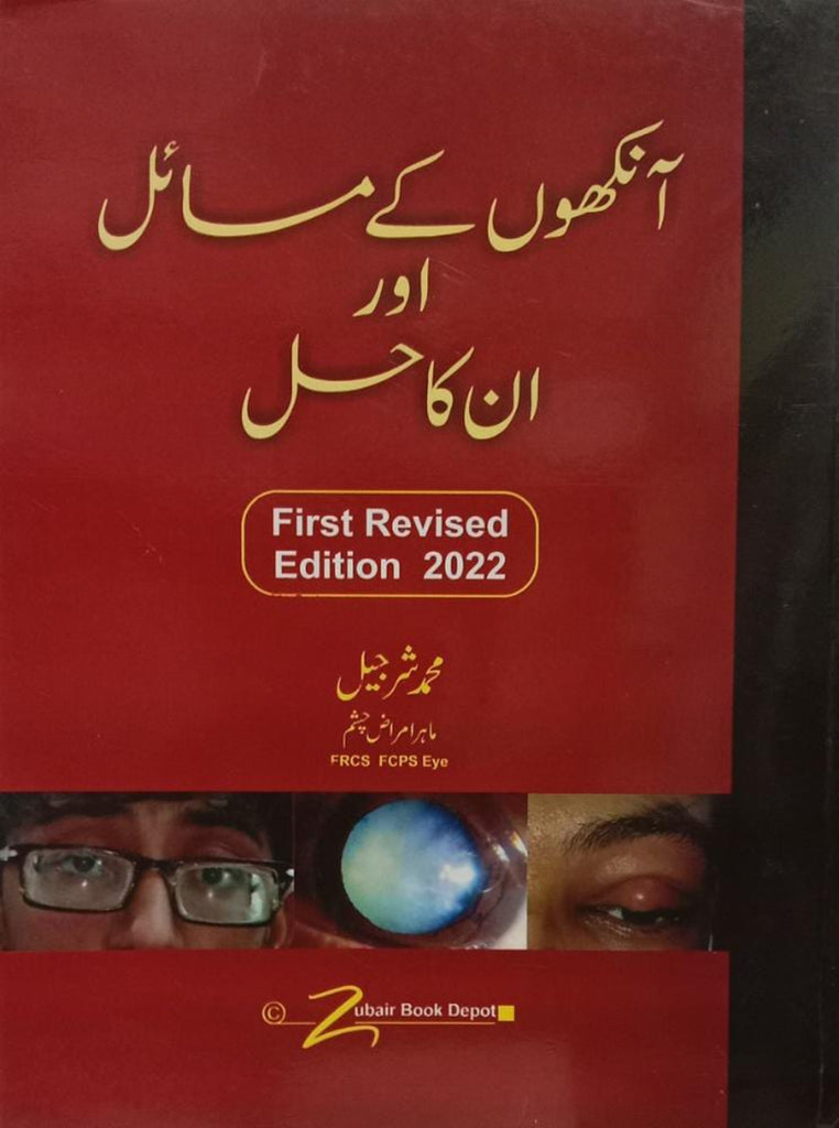 Ankhoon Kay Masail Aur Unka Hal - آنکھوں کے مسائل اور ان کا حل ...